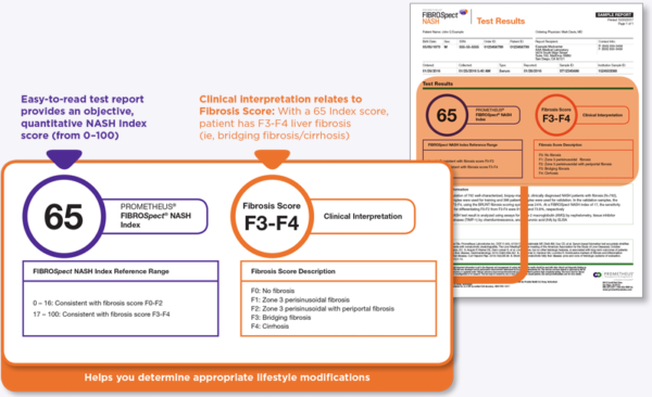FIBROSpect NASH - Prometheus Laboratories